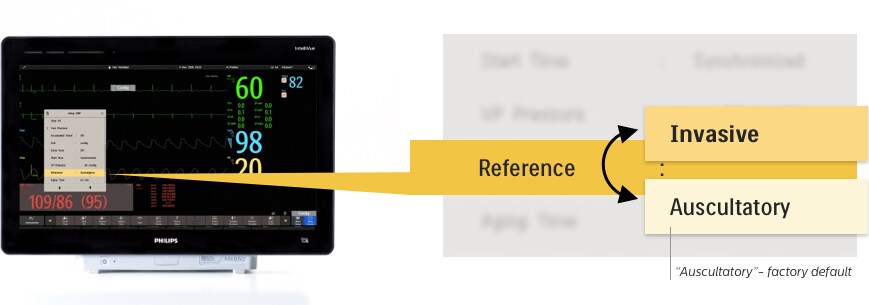 Non-invasive blood pressure measurement | Philips Healthcare